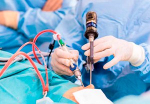 Etmoidectomia │ Hospital Ruben Berta