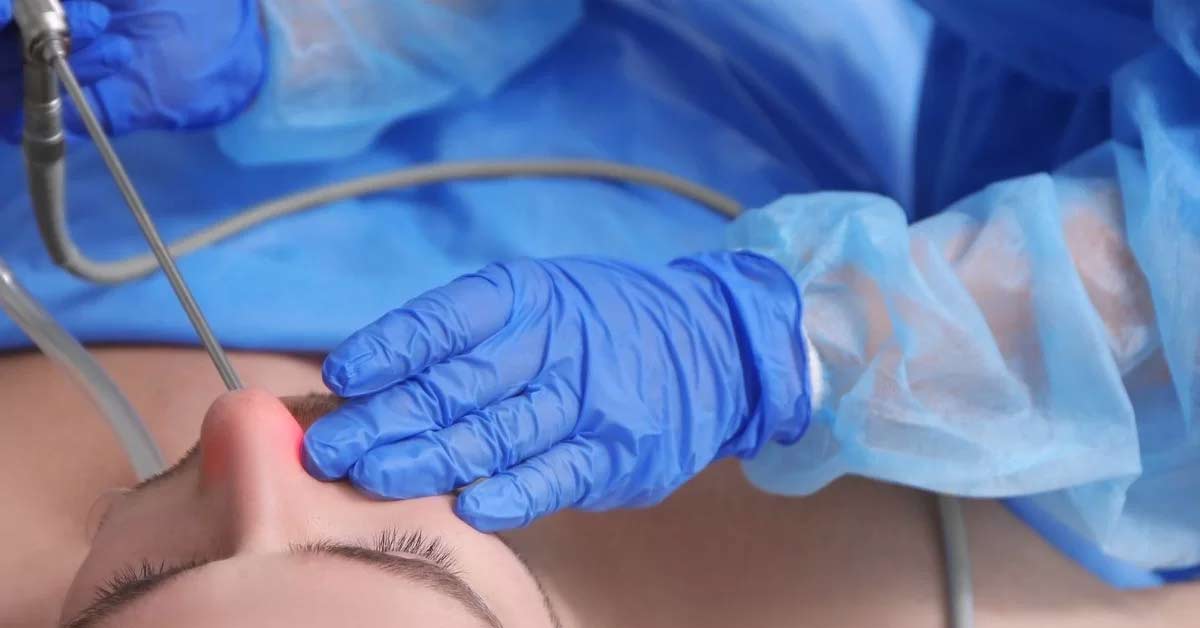 Sinusite: quando considerar uma cirurgia?